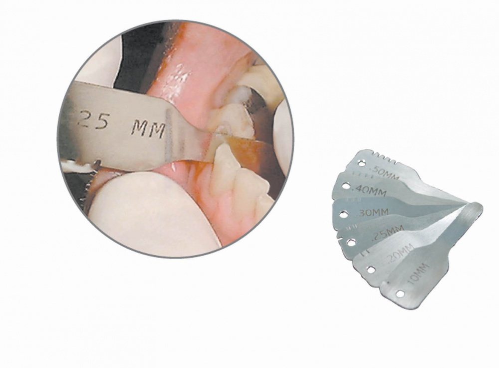 Incremental Thickness Gauge - Miscellaneous - TOC Dental